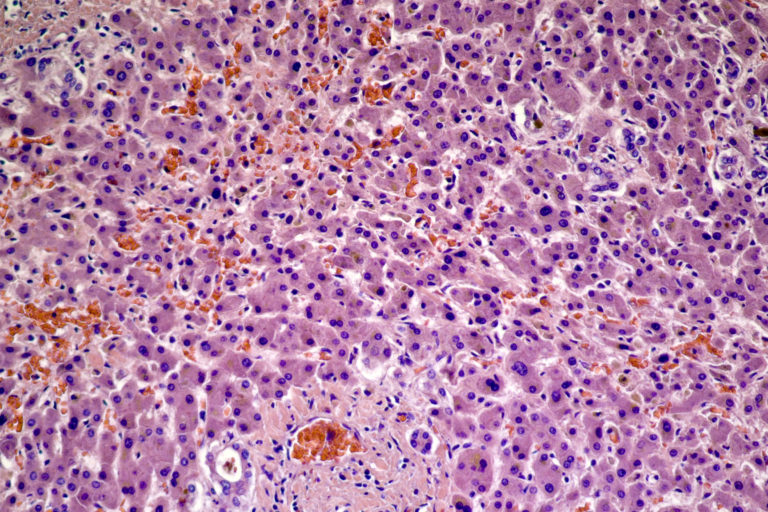 NORMAL LIVER sample - Lab-Ally