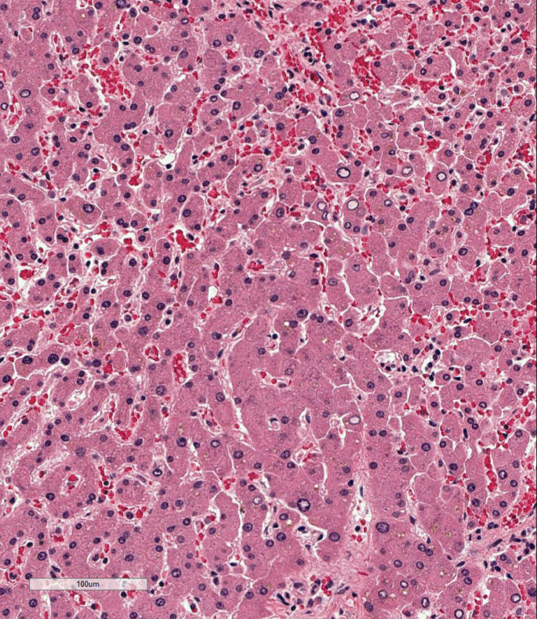 Normal Liver tissue sample for research - Lab-Ally